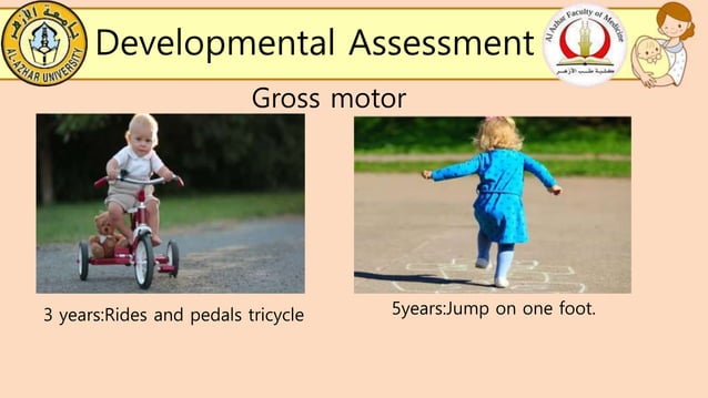 Global Developmental Delay (GDD) | PPTX | Parenting Babies and Toddlers ...