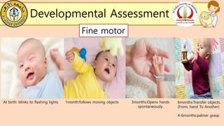 Global Developmental Delay (GDD) | PPTX