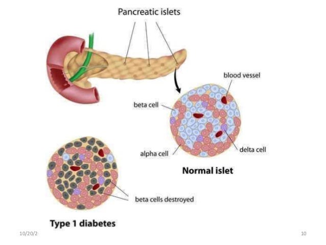 Gestational Diabetes Mellitus and Nursing Management