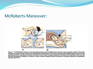 Gestational Diabetes Mellitus | PPTX