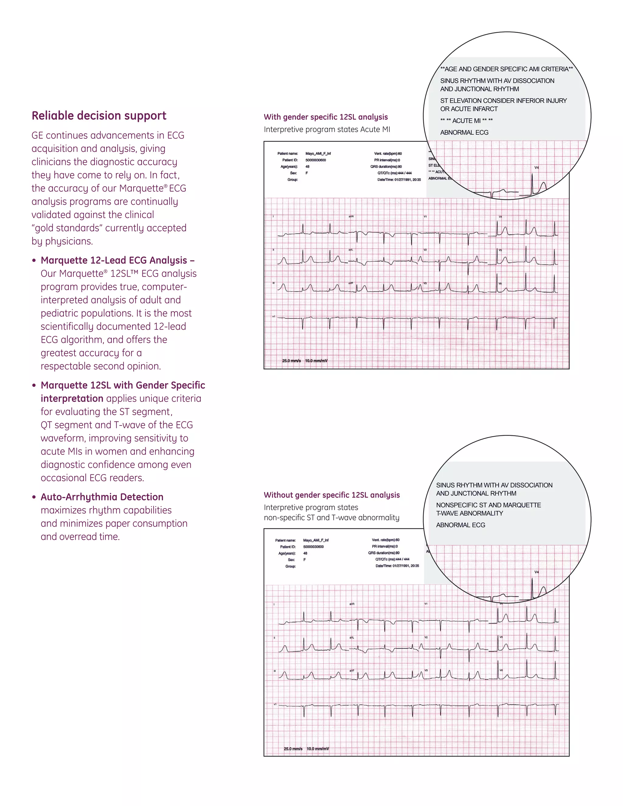 Ge mac1200 ekg machines | PDF