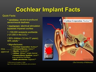 Cochlear Implants | PPT
