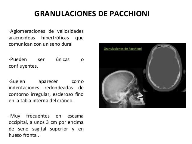 Lectura de caso clínico: Granuloma eosinófilo