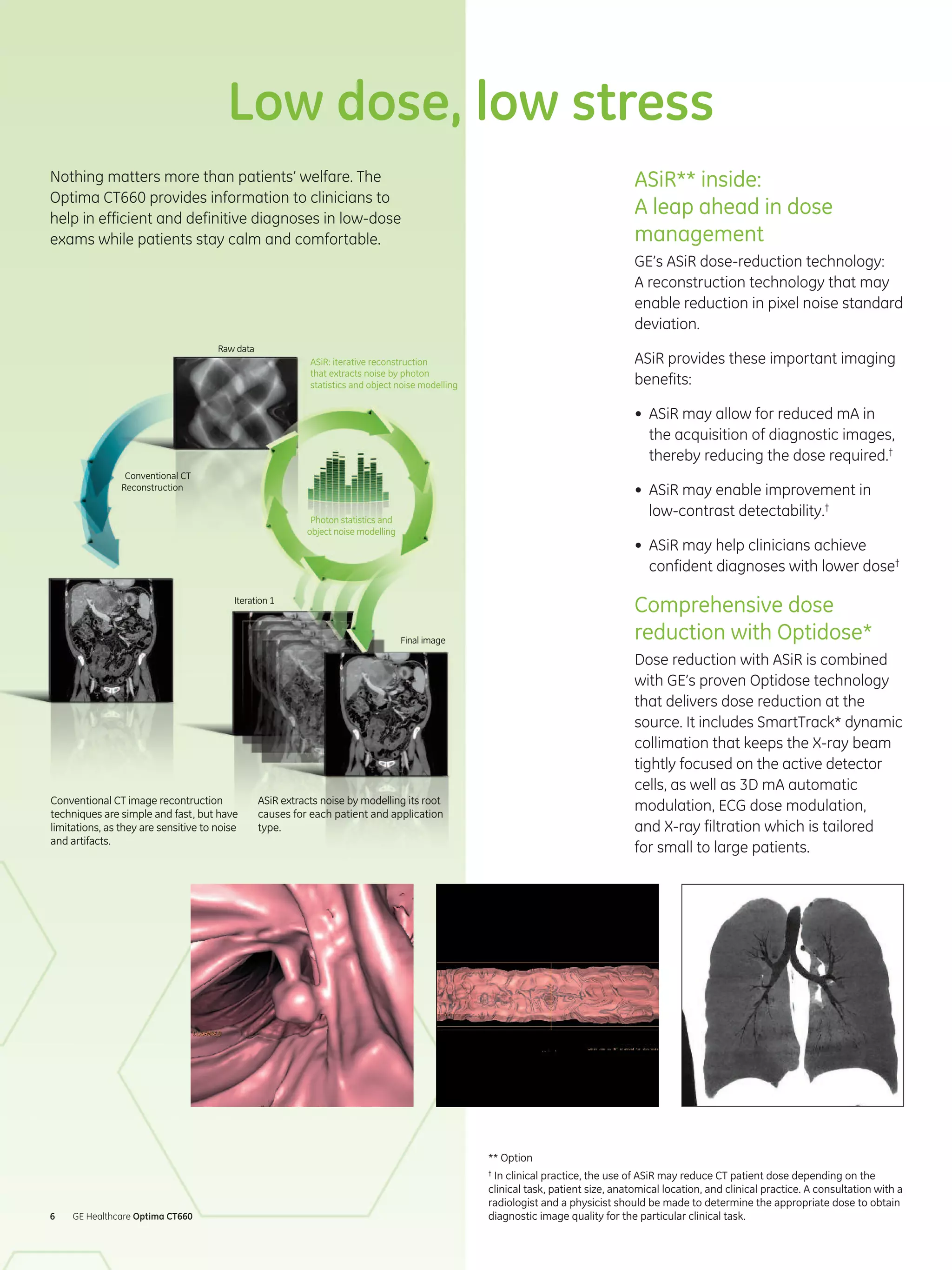 GE Healthcare Optima CT660 | PDF