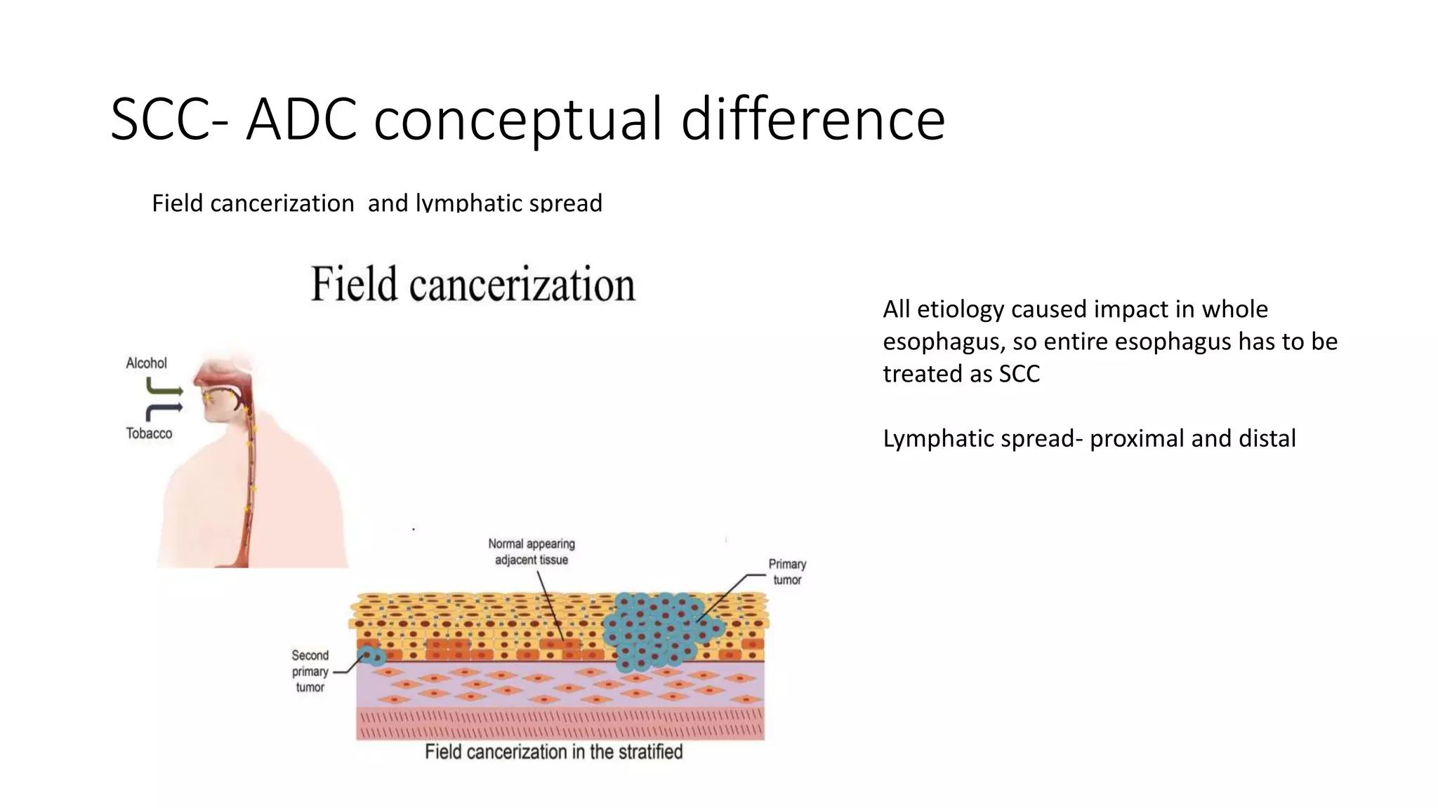 GE junction tumor-pptx | PPTX