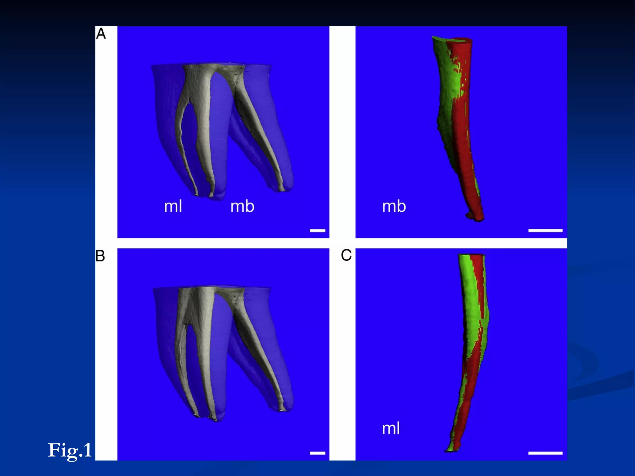 Rotary Instrumentation | PPT | Oral care | Personal Care