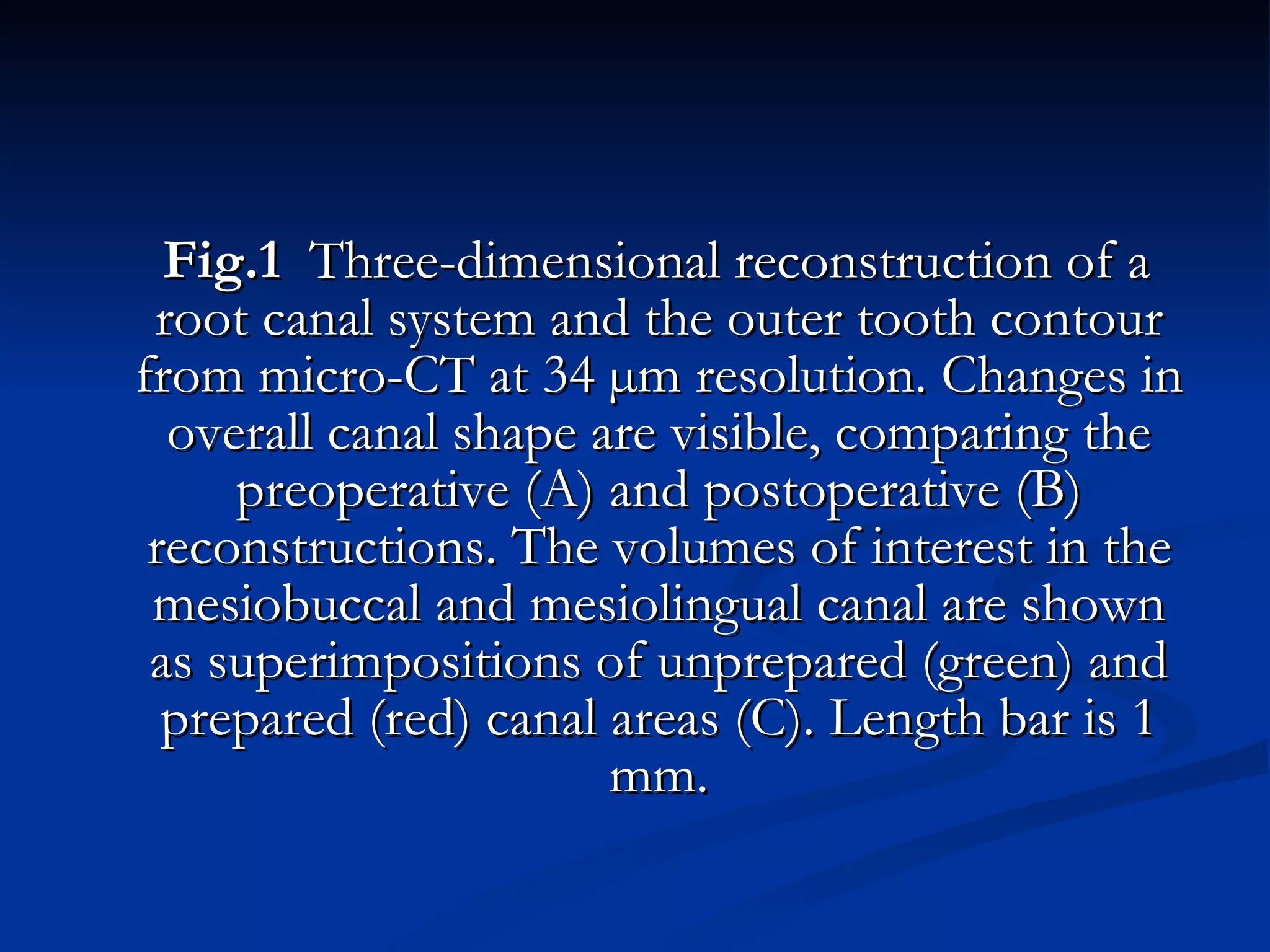 Rotary Instrumentation | PPT | Oral care | Personal Care