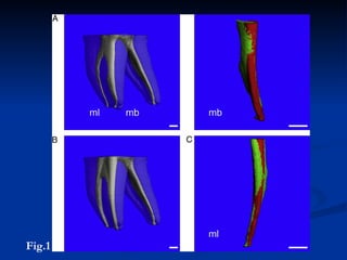 Rotary Instrumentation | PPT | Oral care | Personal Care