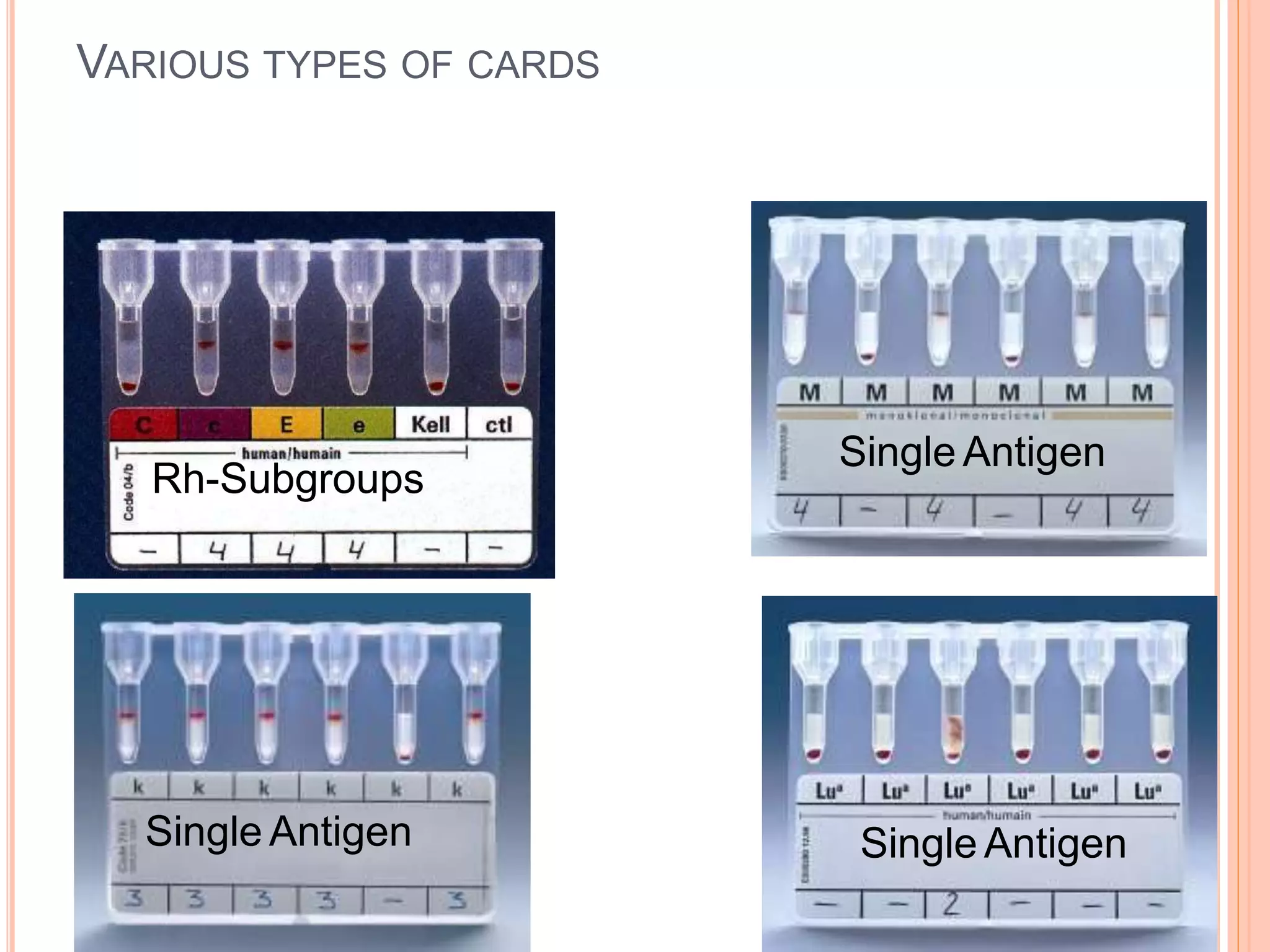 Gel card technology ppt nc | PPTX