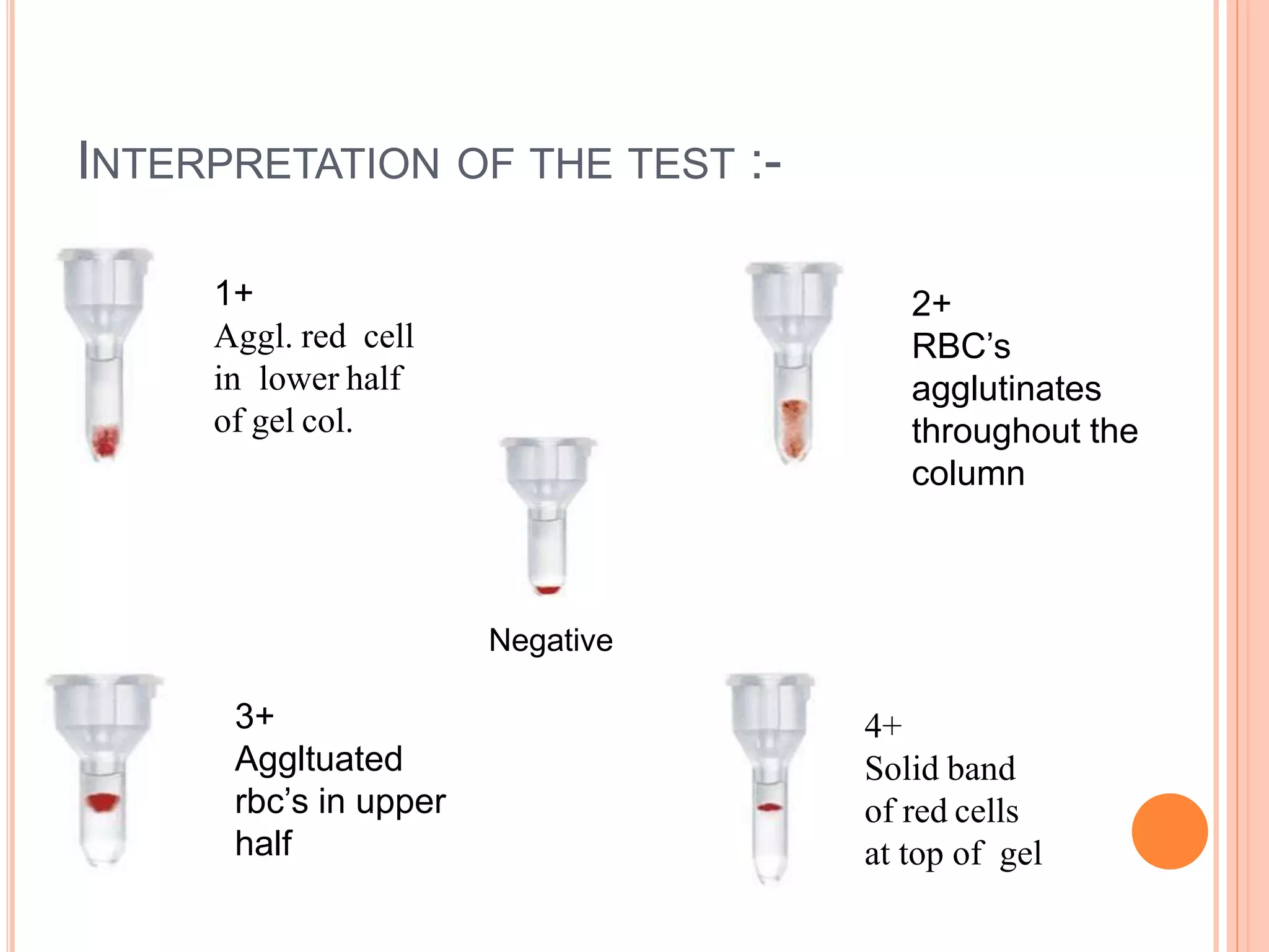 Gel card technology ppt nc | PPTX