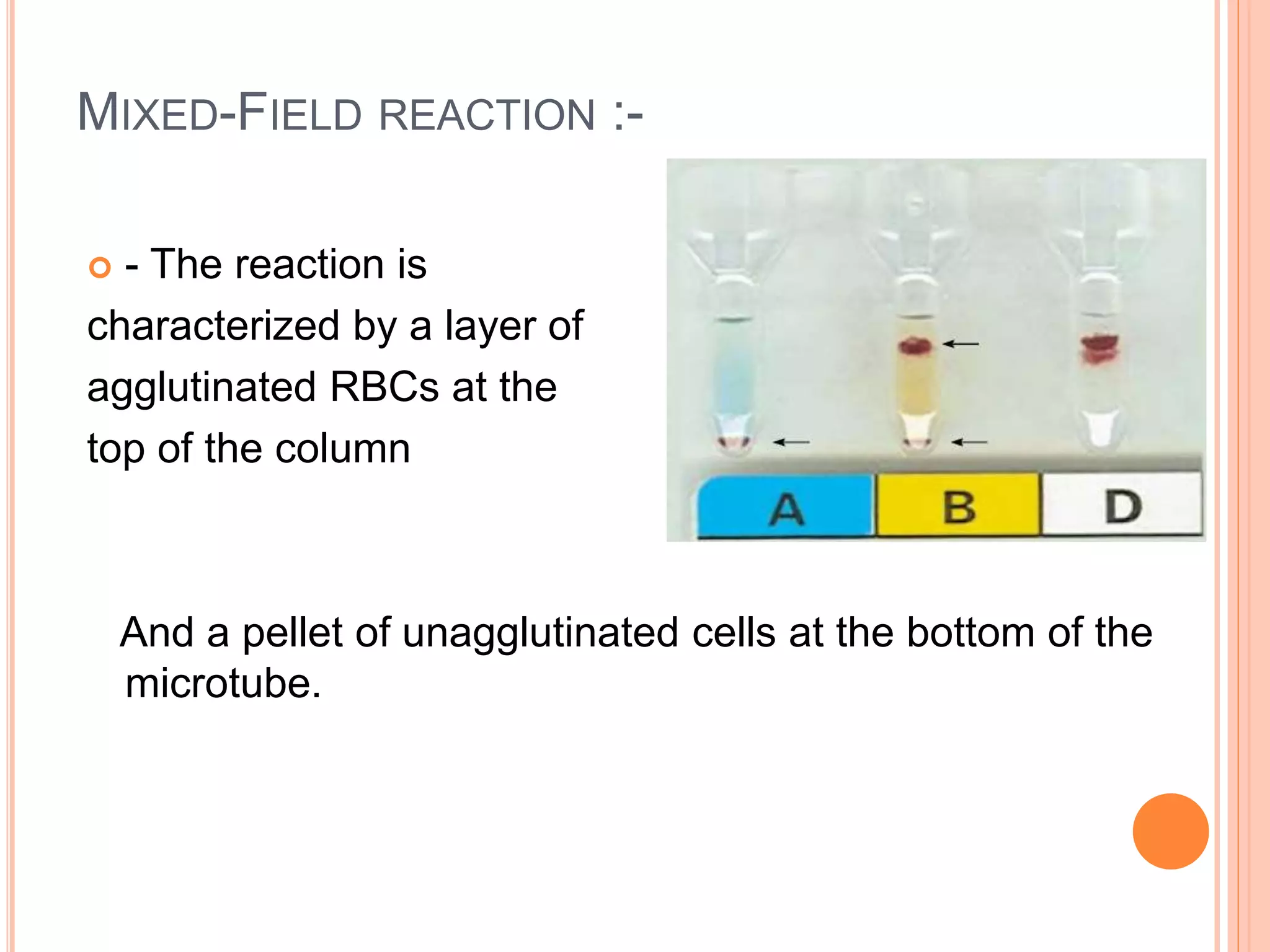 Gel card technology ppt nc | PPTX