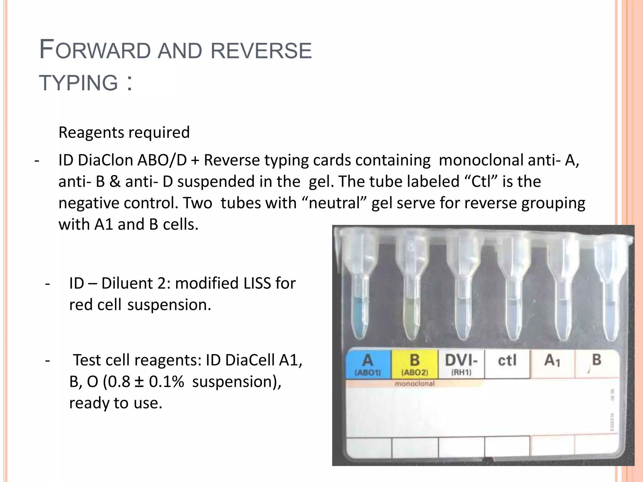 Gel card technology ppt nc | PPTX