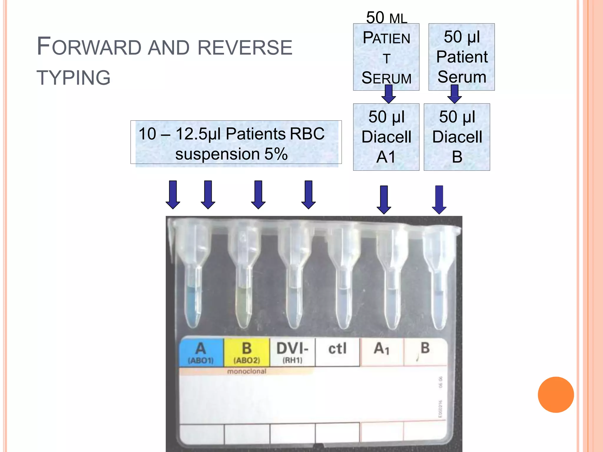Gel card technology ppt nc | PPTX