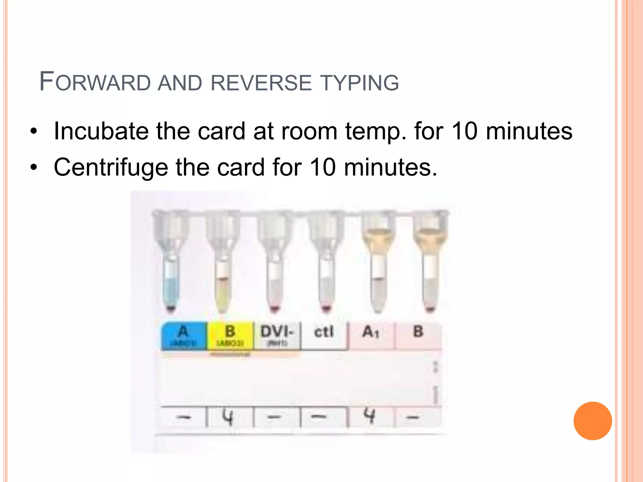 Gel card technology ppt nc | PPTX