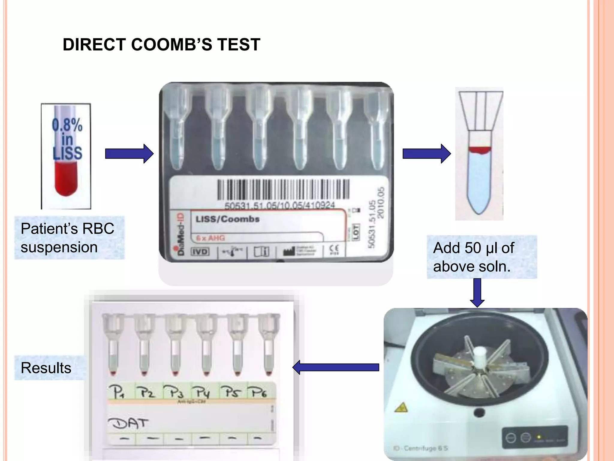 Gel card technology ppt nc | PPTX