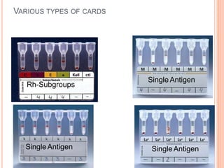 Gel card technology ppt nc | PPTX