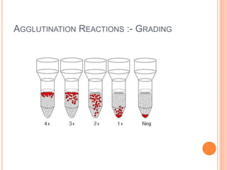 Gel card technology ppt nc | PPTX