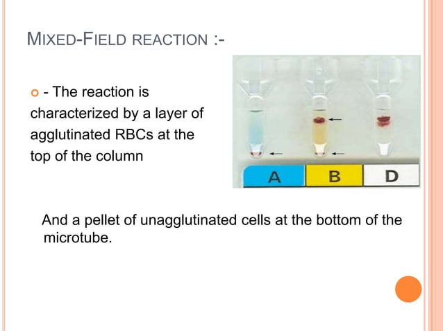 Gel card technology ppt nc | PPTX