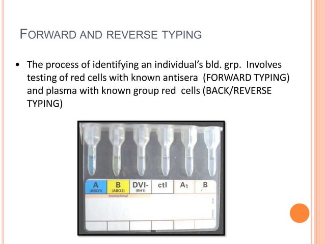 Gel card technology ppt nc | PPTX