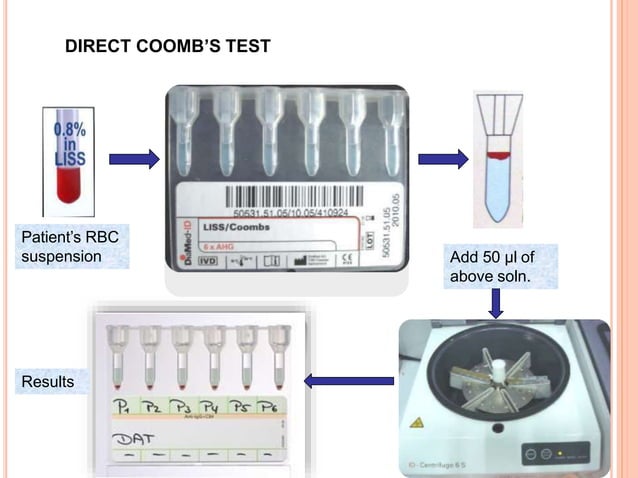 Gel card technology ppt nc | PPTX