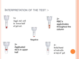 Gel card technology ppt nc | PPT