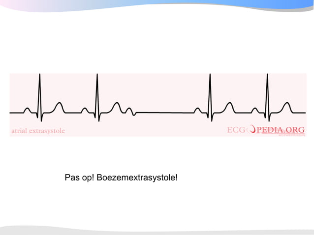 ECGpedia ECG course: conduction | PPT