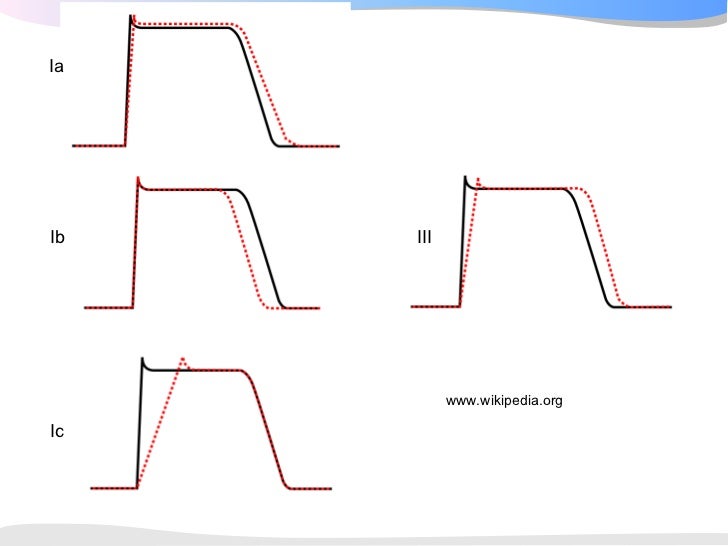 Geleidingstoornissen ECGpedia 2008