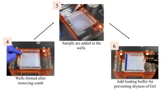 AGAROSE Gel Electrophoresis for DNA Separation | PPTX