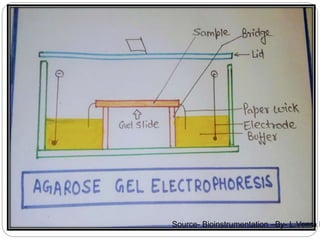 Electrophoresis Diagram