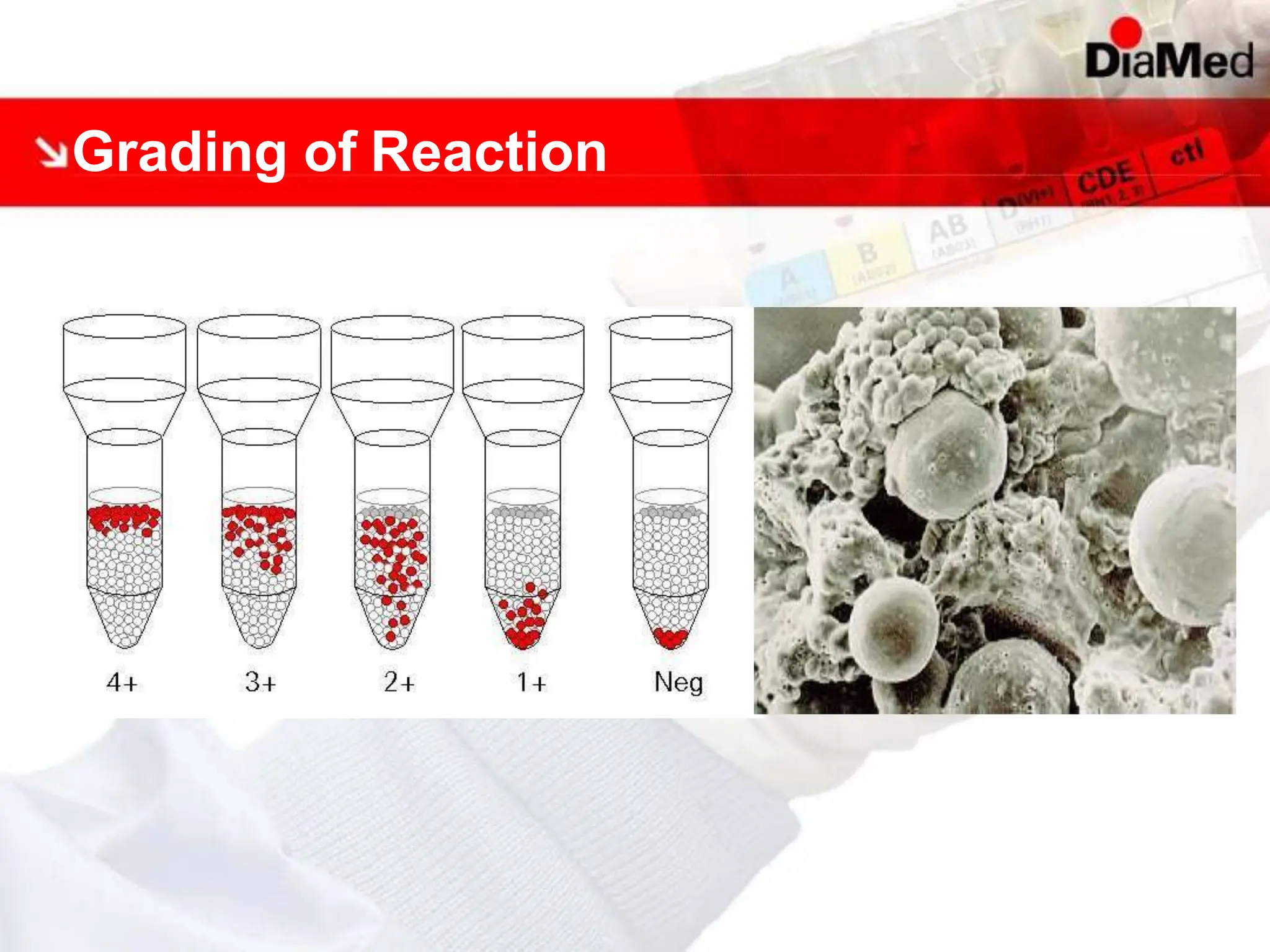 Column agglutination gel techniques.pptx