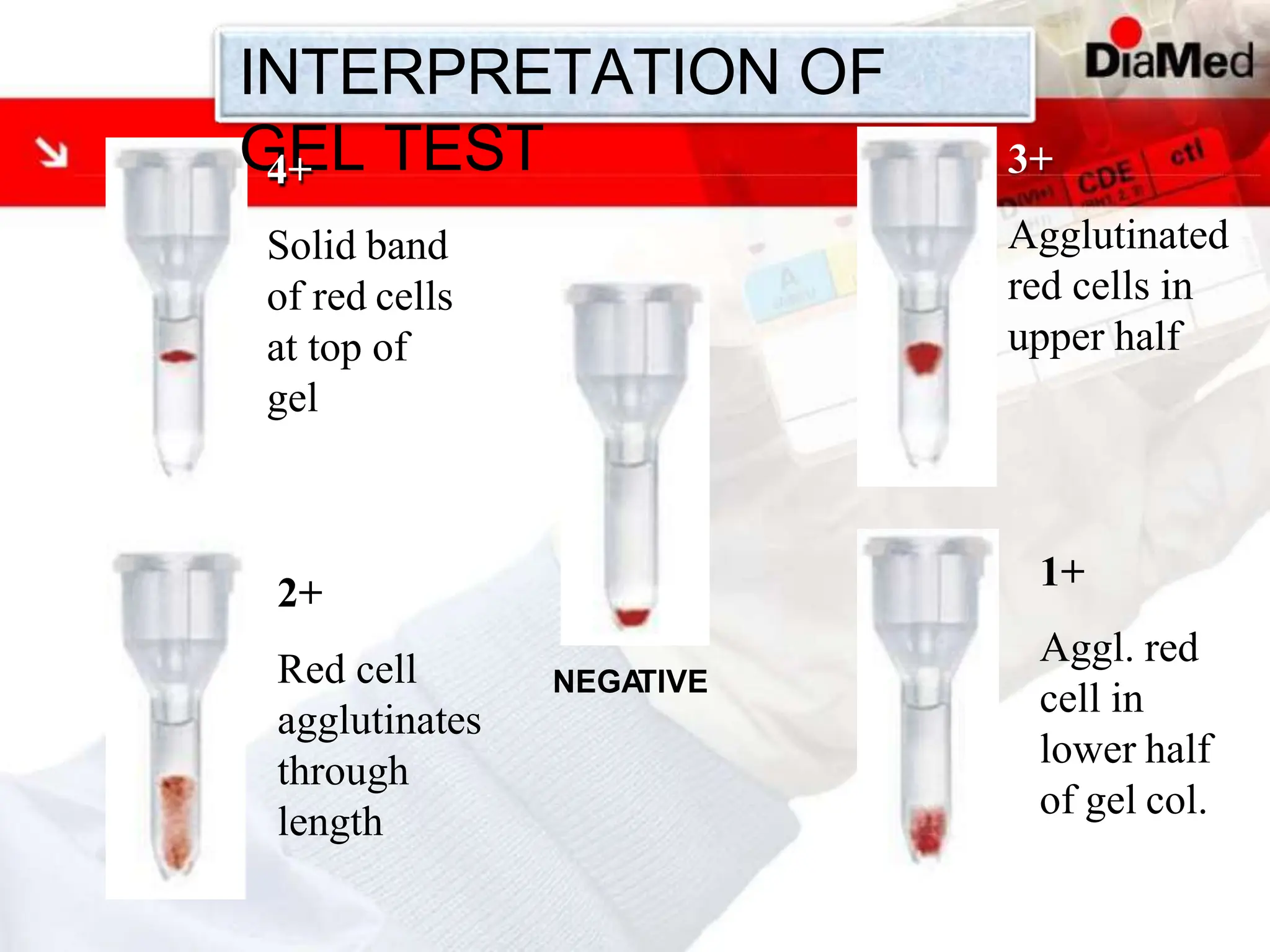 Column agglutination gel techniques.pptx
