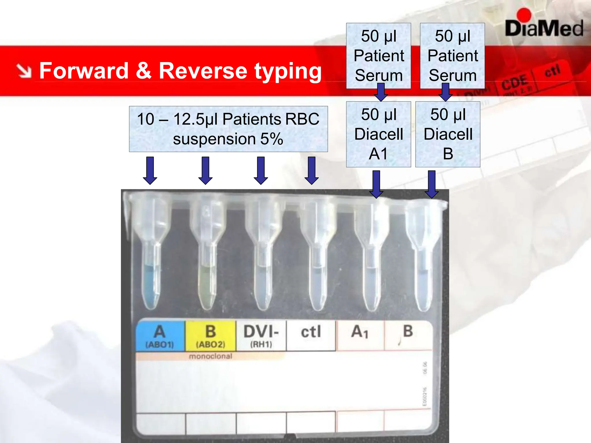 Column agglutination gel techniques.pptx
