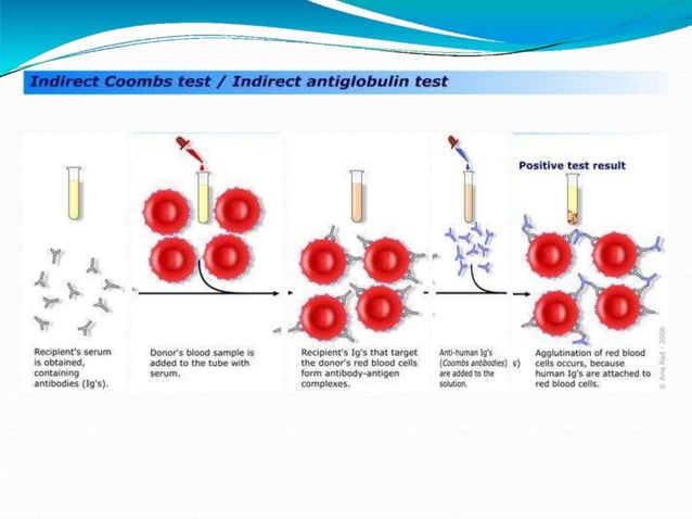 Column agglutination gel techniques.pptx | Blood Disorders | Diseases ...