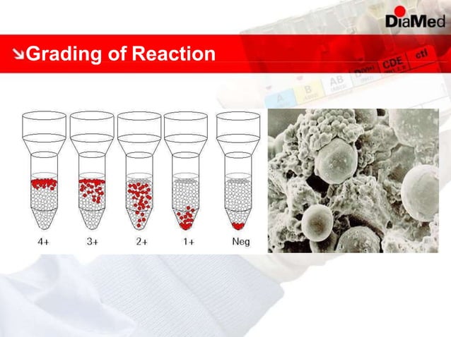 Column agglutination gel techniques.pptx | Blood Disorders | Diseases ...