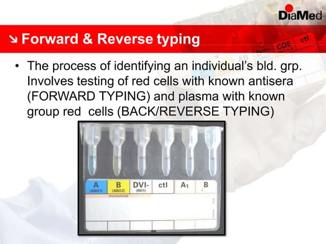 Column agglutination gel techniques.pptx | Blood Disorders | Diseases ...