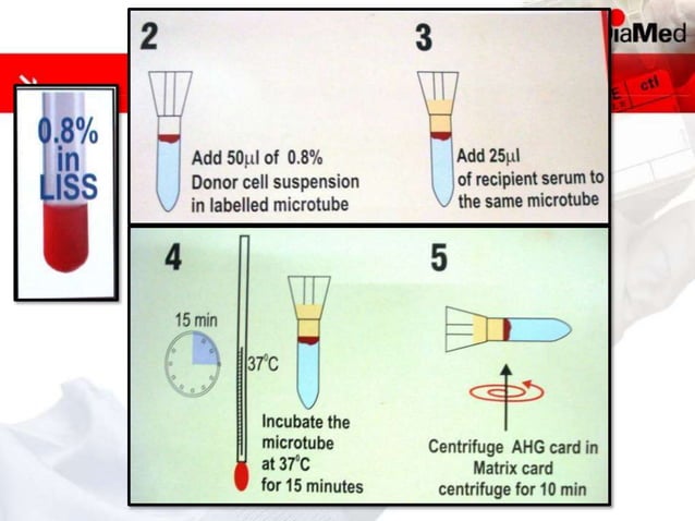 Column agglutination gel techniques.pptx | Blood Disorders | Diseases ...