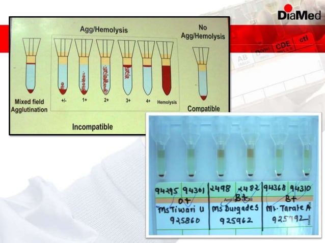 Column agglutination gel techniques.pptx | Blood Disorders | Diseases ...