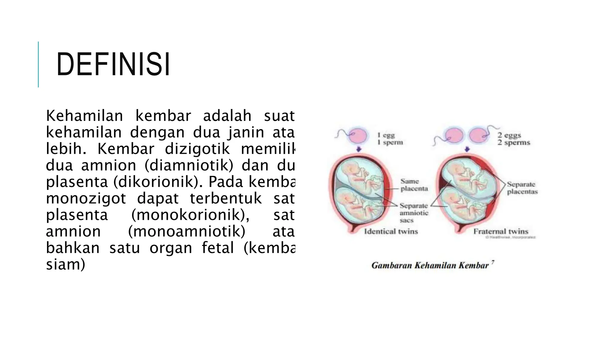PPT EDUKASI KEHAMILAN KEMBAR ATAU GAMELI | PPT