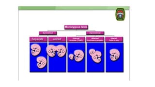 PPT EDUKASI KEHAMILAN KEMBAR ATAU GAMELI | PPT