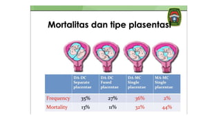 PPT EDUKASI KEHAMILAN KEMBAR ATAU GAMELI | PPT
