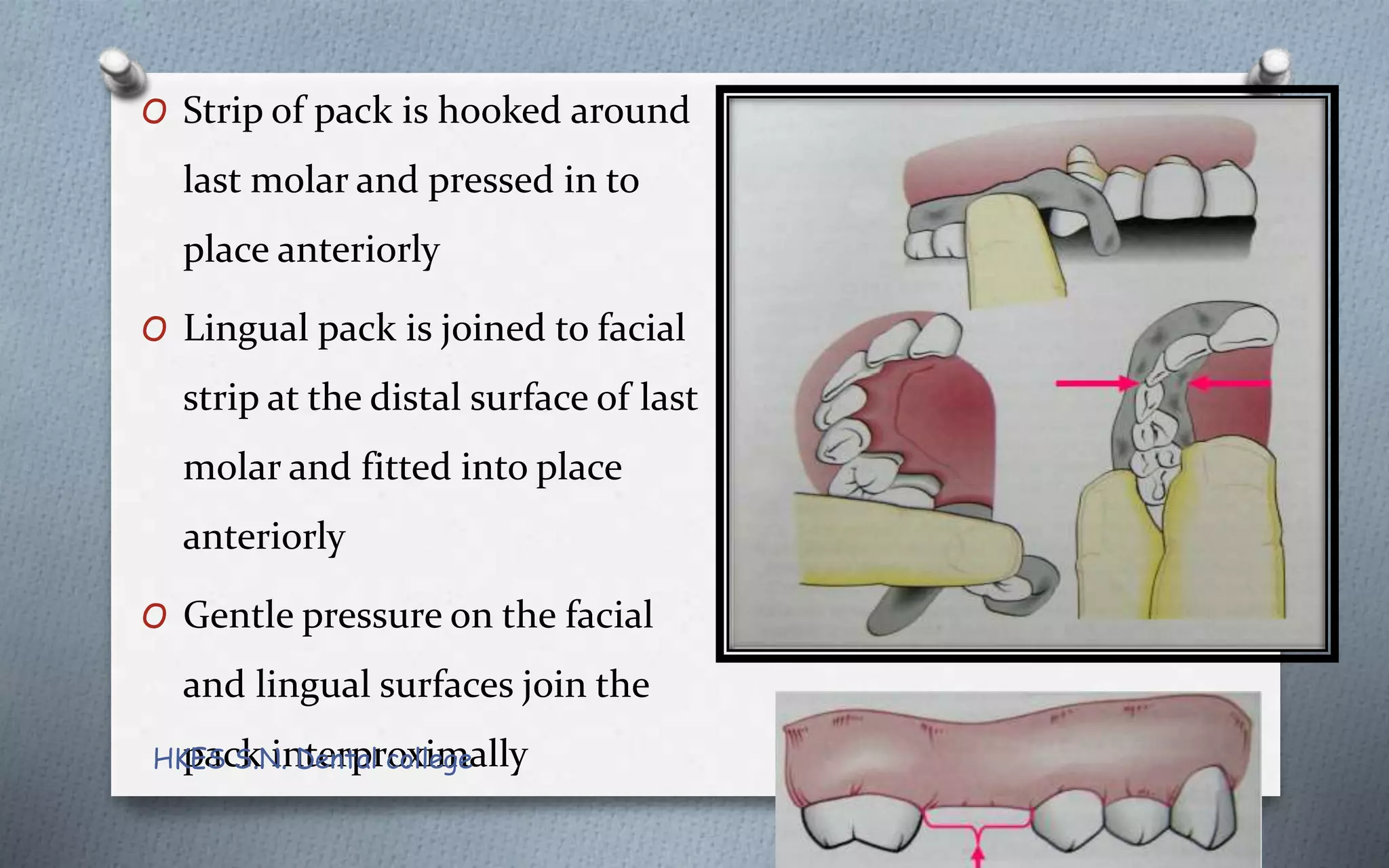 General principles of Periodontal surgery | PPTX