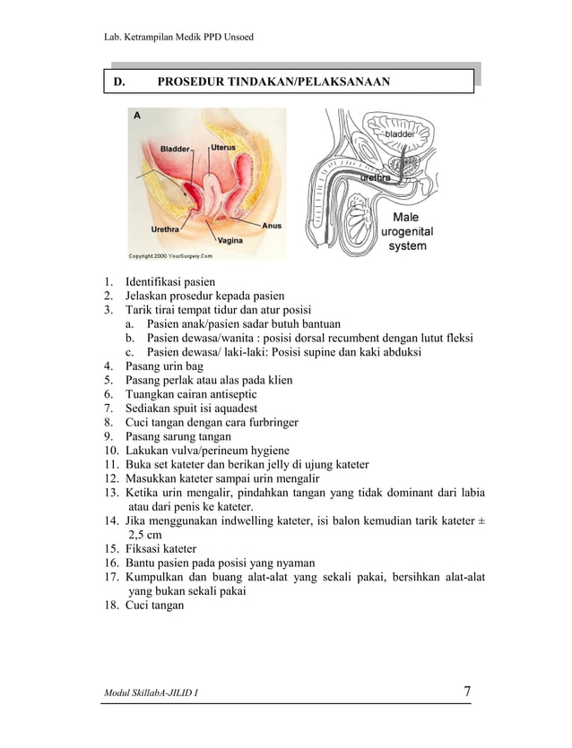 tekhnik pemasangan kateter urin