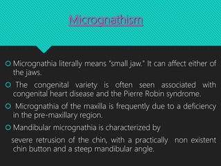 Genaral factors of malocclusion of teeth | PPTX