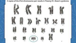 GEN BIO G2- DOWN SYNDROME report (1).pdf