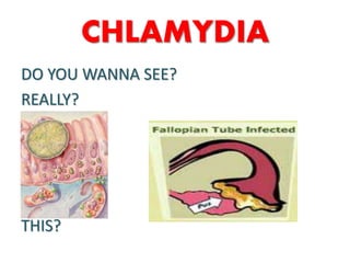 Gender and Sexuality | PPTX