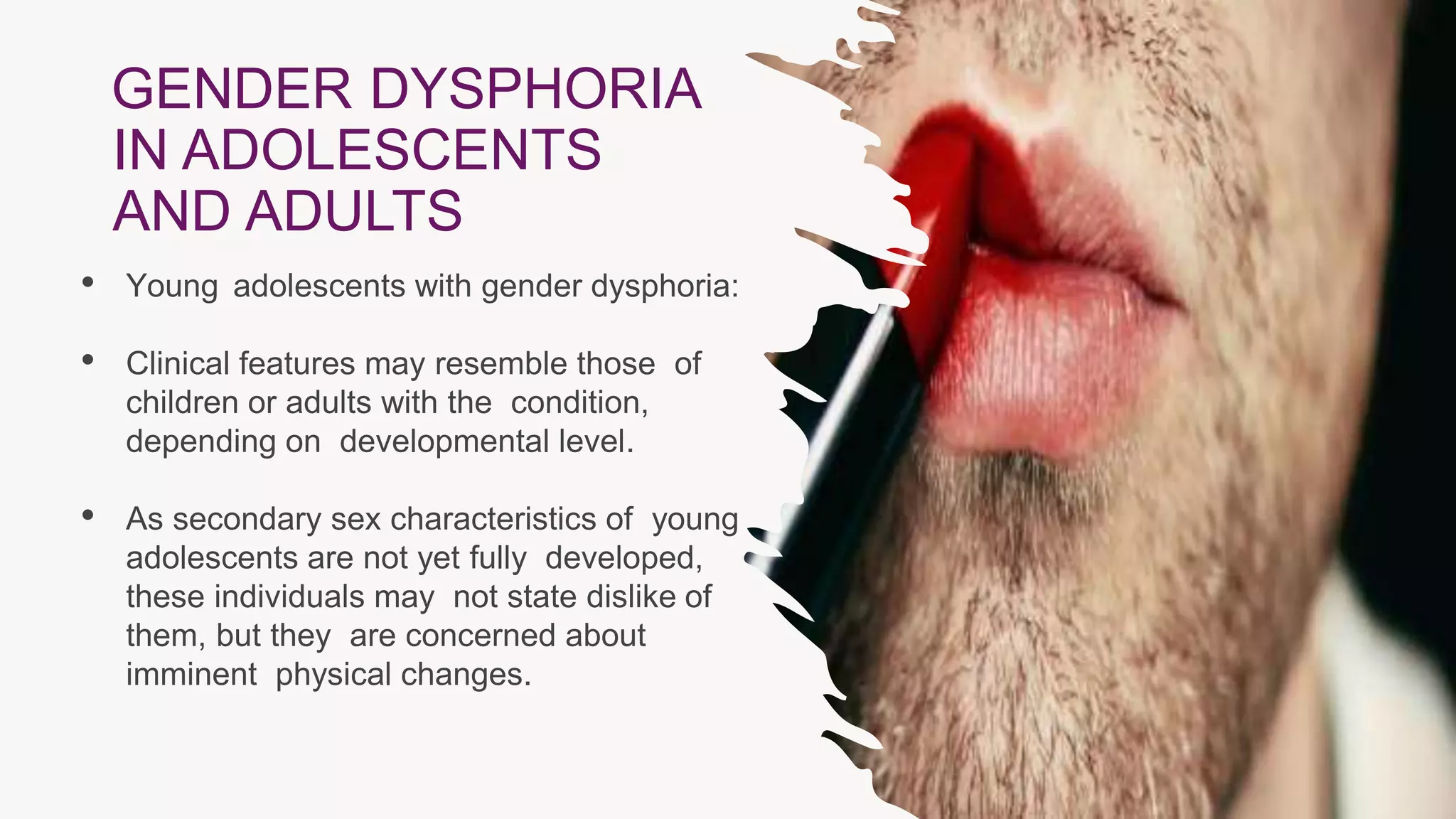 Gender Dysphoria.pptx
