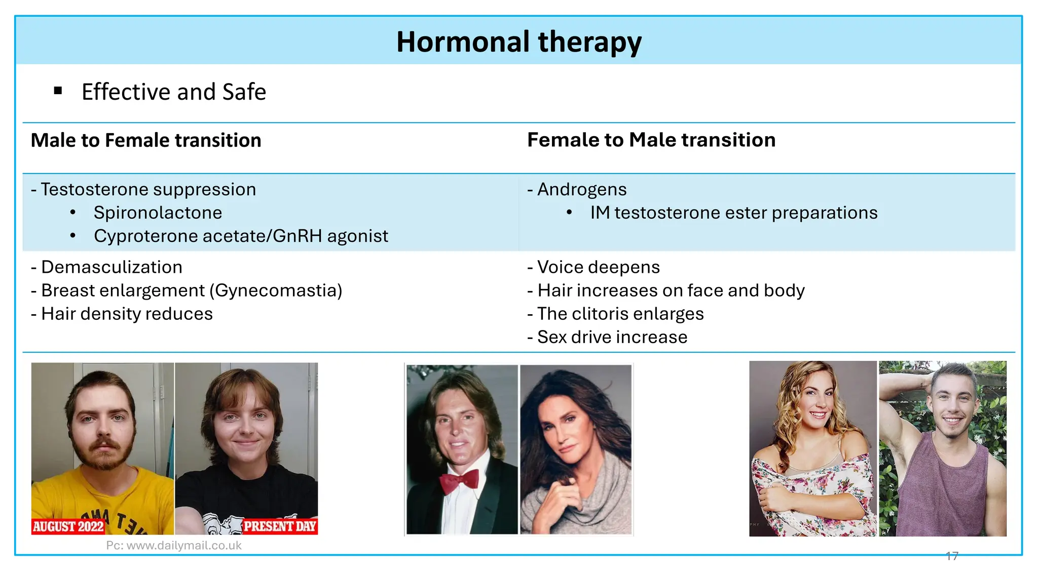 Gender dysphoria(Gender Identity disorder).pdf