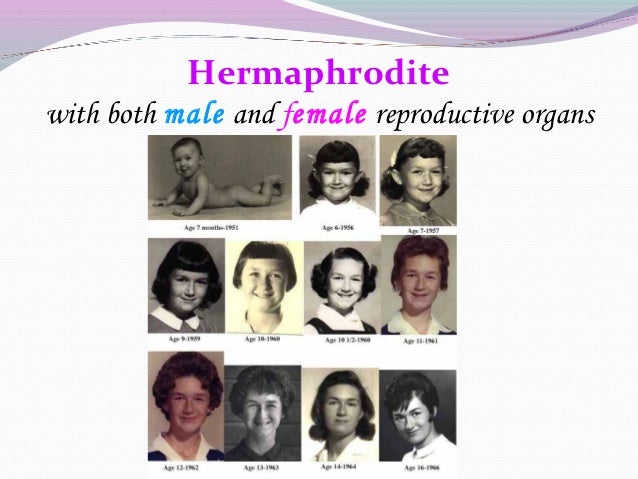 Hermaphrodite In Humans