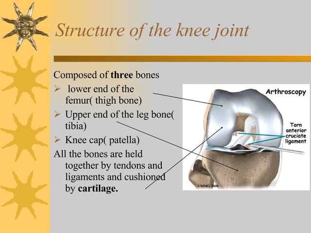 Gender Specific High Flex Knee replacement