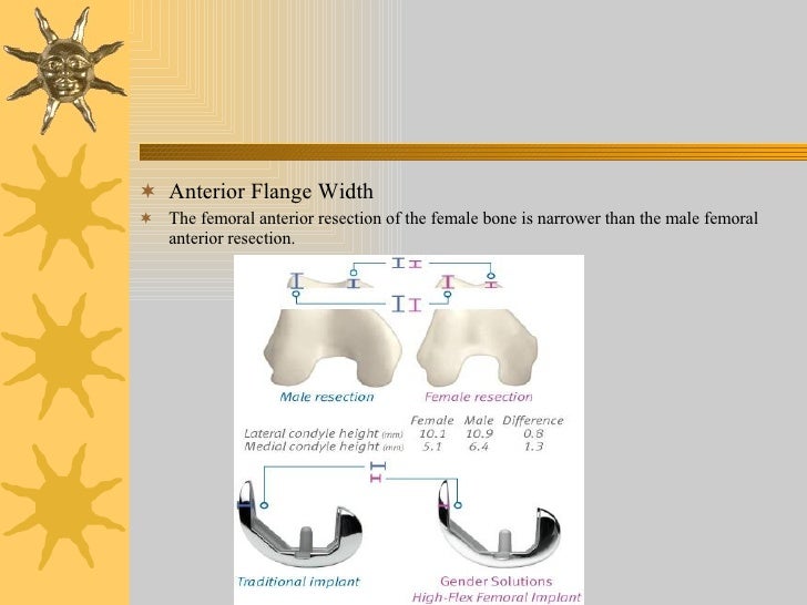 Gender Specific High Flex Knee replacement